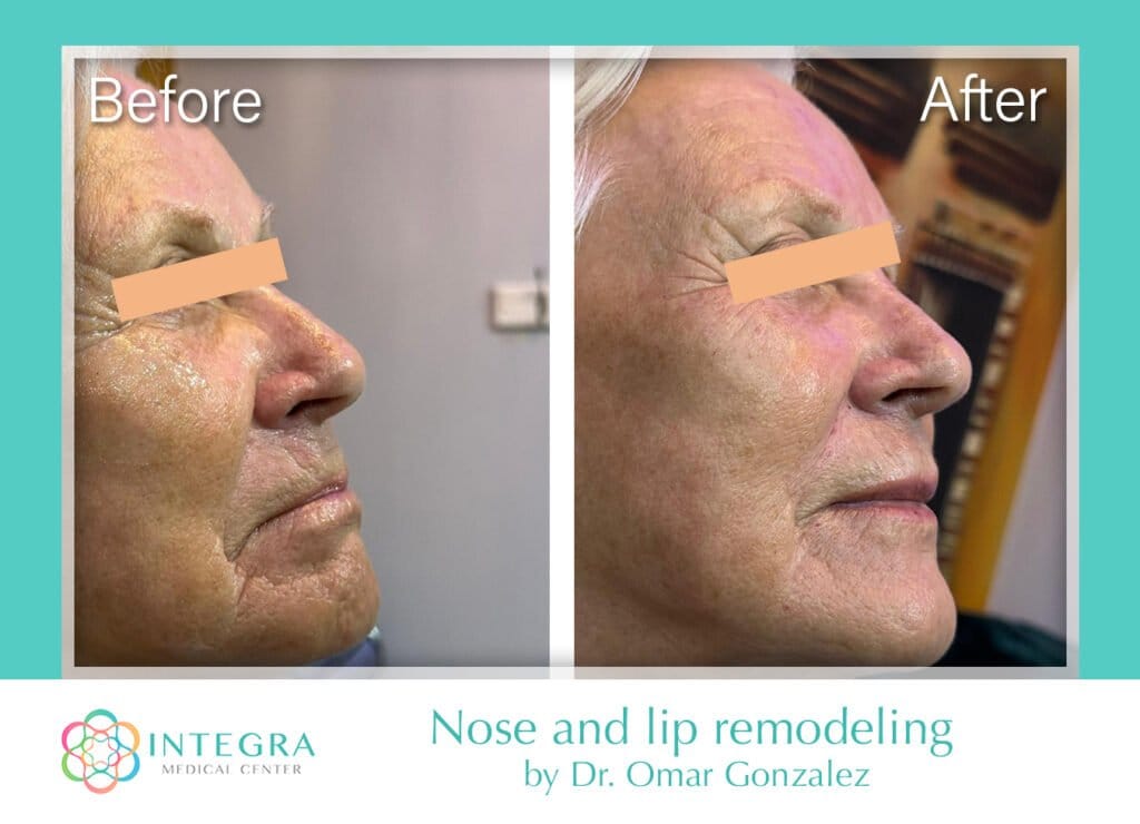 Dr. Omar Gonzalez - Stem Cell Expert In Nuevo Progresso